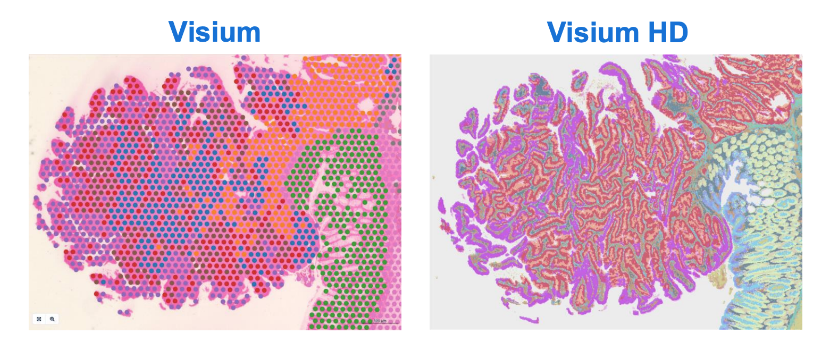 Visium HD Spatial Gene Expression: Revolutionizing Biological Insights – AffiGEN